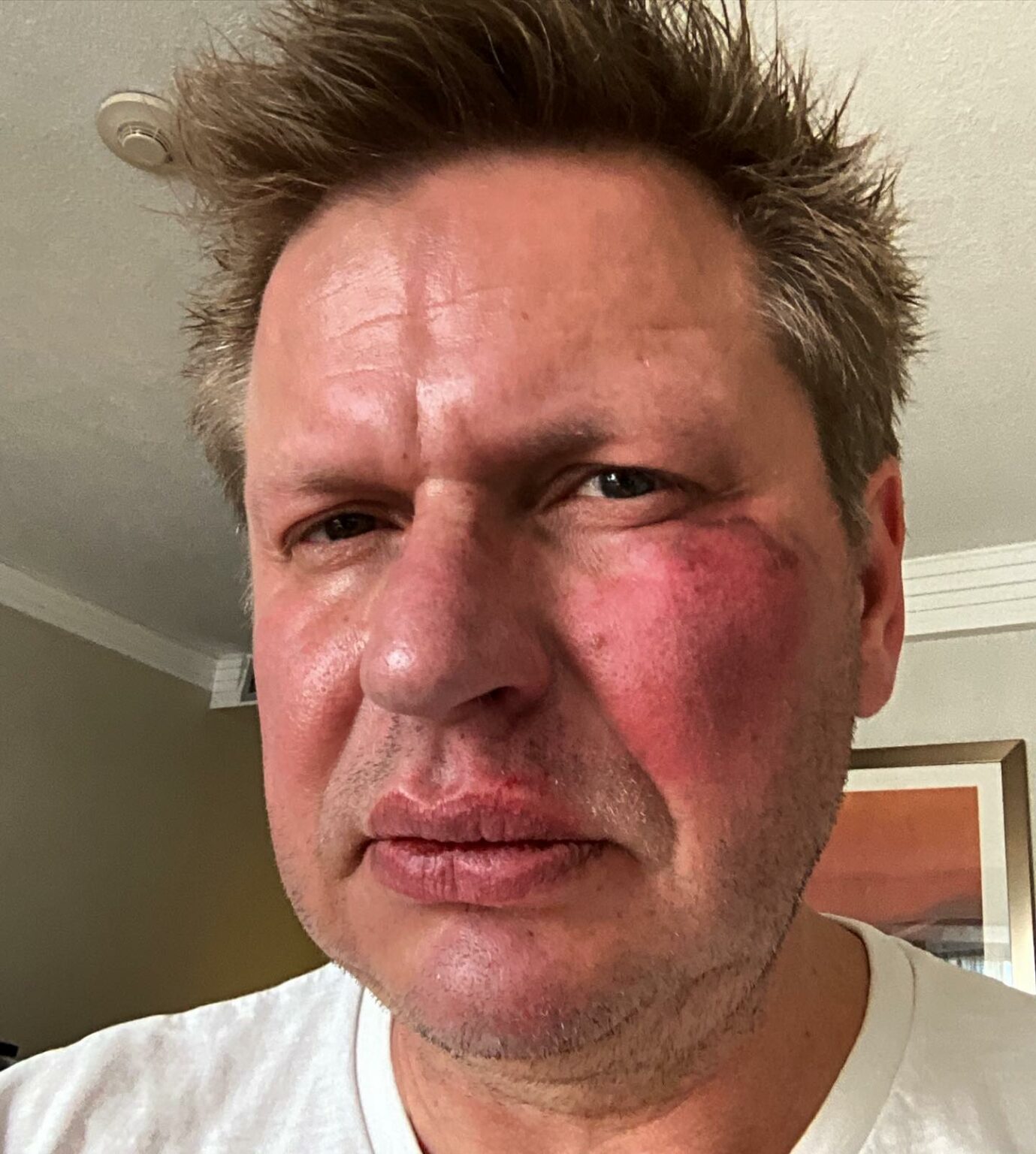 Timo Maas auf offener Straße überfallen und ausgeraubt